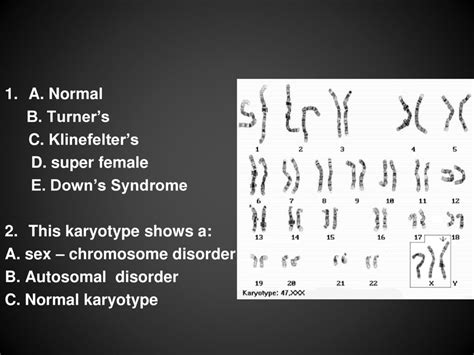 Be Familiar With The Term Nondisjunction Ppt Download