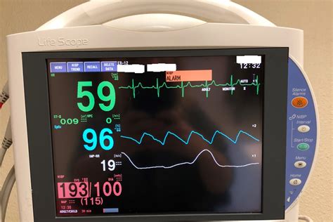 Treating Anxiety Depression In People With Heart Disease Reduced Er
