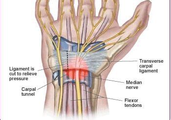 Transverse Ligament Hand