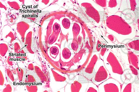 Trichinella Spiralis Trichinellosis Longitudinal Section 250x