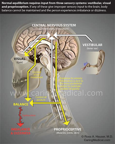 Vertigo And The Vestibular System Human Ear Balance Vestibular