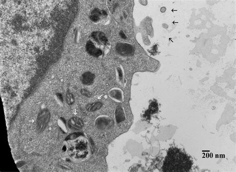 18 Bf Tem Image Of A Cell With Pyknotic Mitochondria White Arrows Download Scientific