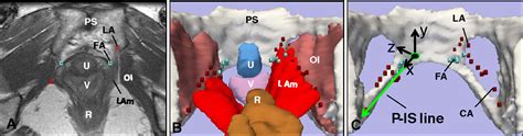 Structure Of Tendinous Arch Of Pelvic Fascia Semantic Scholar