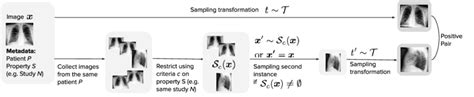 Selecting Positive Pairs For Contrastive Learning With Patient Metadata Download Scientific
