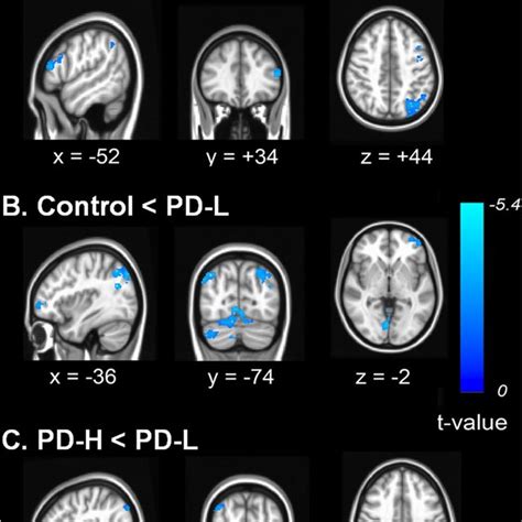 Comparison Of Cortico Cortical Functional Connectivity From The