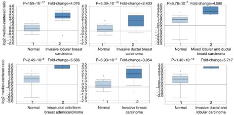 Analysis Of Muc1 Gene Expression Of The Patients With Breast Cancer