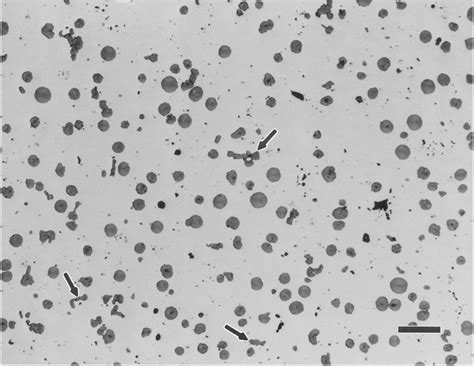 16 Example Of A Ductile Iron Specimen With Numerous Vermicular Graphite Download Scientific