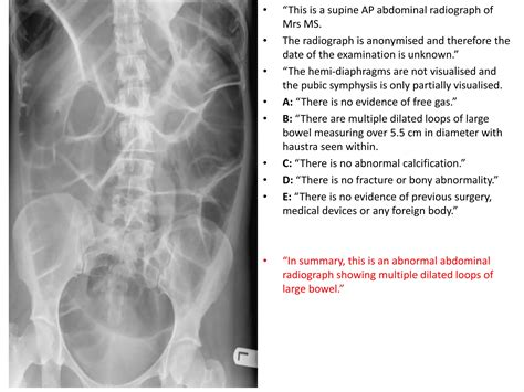 Abdominal Reportpptx
