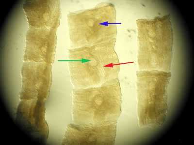Cdc Dpdx Mesocestoidiasis