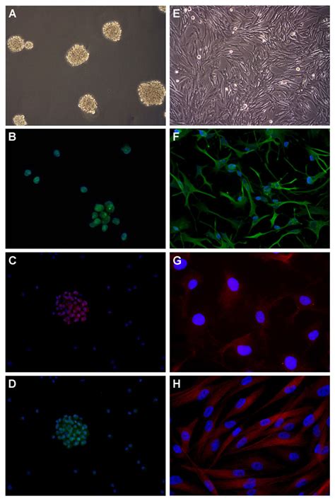 Development Of Cell Lines By In Vitro Culture Of Newly Diagnosed Gb And