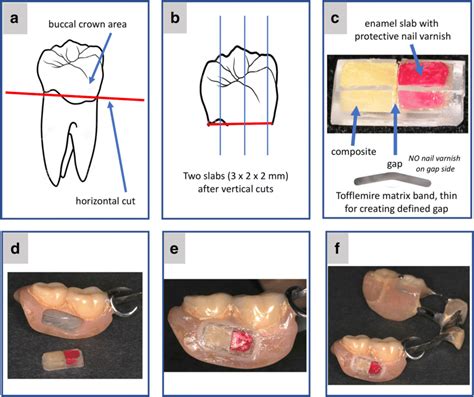 Schematics Demonstrating The Process From Cutting The Tooth Up To