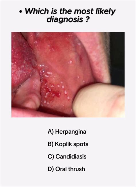 Medical Which Is The Most Likely Diagnosis Facebook