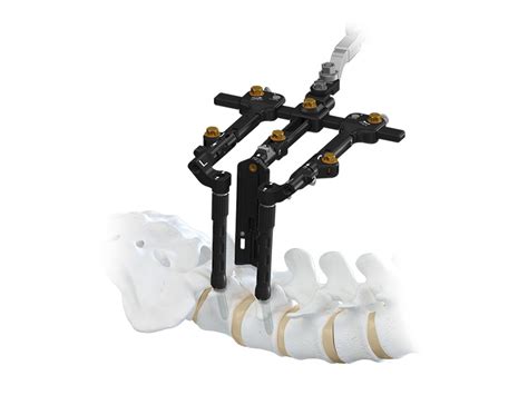 Mars™ Tlif Retractor Globus Medical