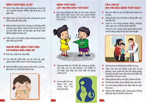 Những điều cần biết về bệnh thủy đậu CDC Hà Nam
