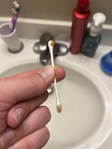 Infected Eardrum And Pus Rearwax