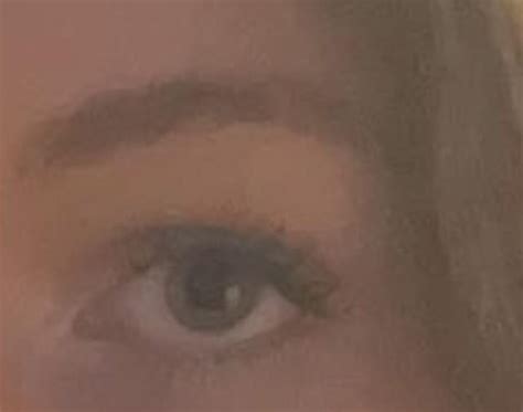 Hypomanic Vs Depression Eyes R Bipolar2