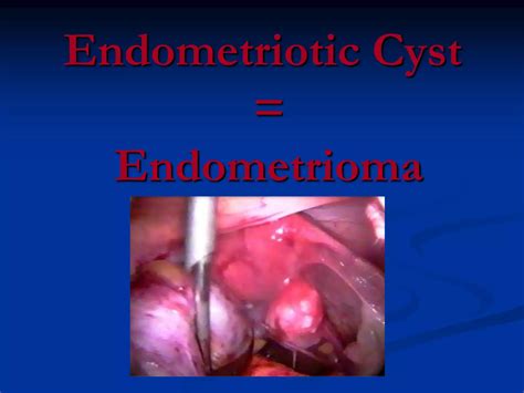 Basics In Gyne Laparoscopy Ppt