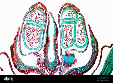 Ephedra Plant Male Cone Light Micrograph Of A Section Through Part Of