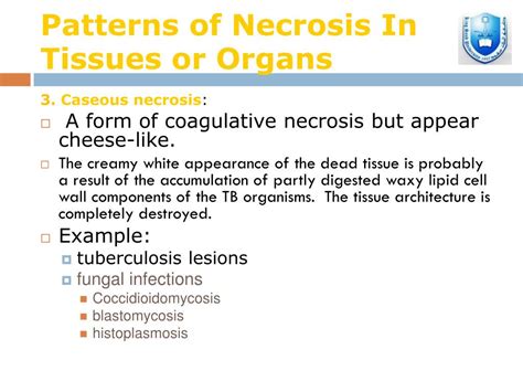 Ppt Necrosis And Apoptosis Powerpoint Presentation Free Download