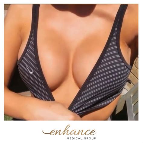 Mentor Breast Implants Shapes And Sizes Enhance Medical
