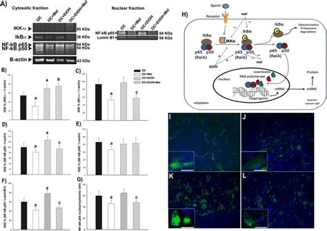 Western Blot Analysis Of Ikk α Ikbα And Nfkb In Serous Papillary