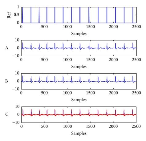 Reference Signal And Extracted Mecg Signals By Both Methods From The Download Scientific