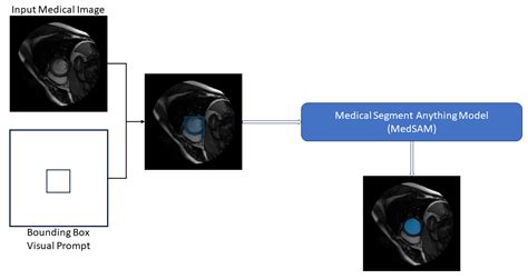 Get Started With Medical Segment Anything Model For Medical Image