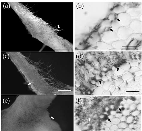 The Ectomycorrhizal Ecm Formation Process Between P Massoniana And Download Scientific