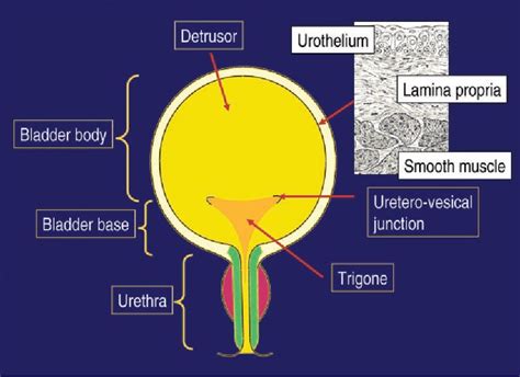 Bladder Neck Obstruction Semantic Scholar