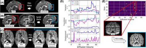 Prequal Performs Artifact Correction A Susceptibility Induced