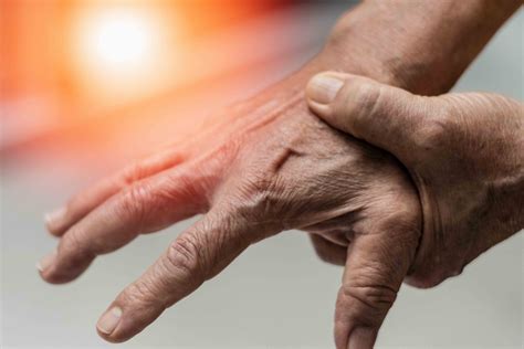 Early Signs And Symptoms Of Arthritis Joan Spencer