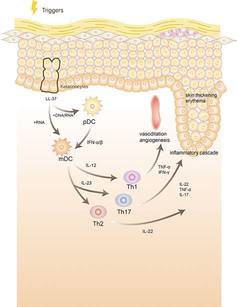 Effects Of Neuropeptides On Dendritic Cells In Psoriasis Jir