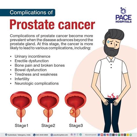 Common Causes Of Prostate Infection