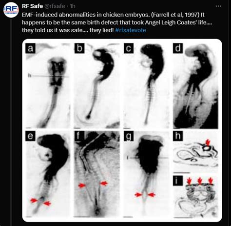 Risks Of Emf Exposure Rf Safe® Radio Frequency Safe