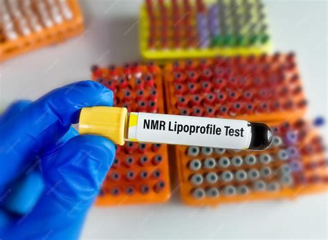 Premium Photo Blood Sample For Nmr Lipoprofile Test