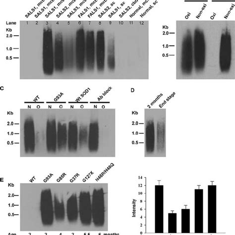 Rna Oxidation Is An Early Event Preceding Motor Neuron Degeneration Download Scientific