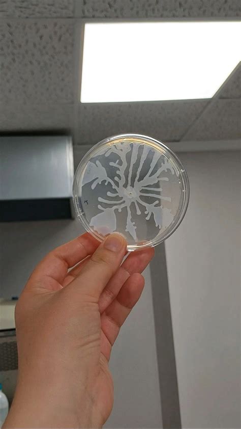 Pseudomonas Aeruginosa In Nutrient Agar 🫶 Aysun B
