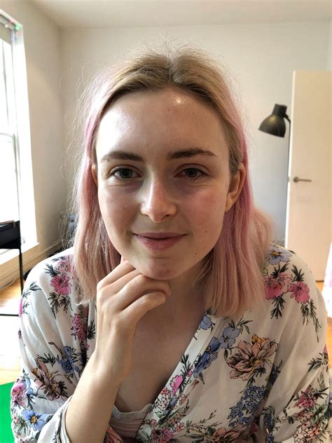 Sådan Er Det Gået Anna Simonsen Øjenforeningen