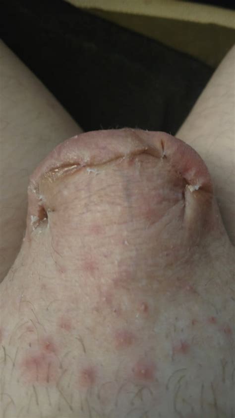 Super Glue Fun 24 Pics Xhamster