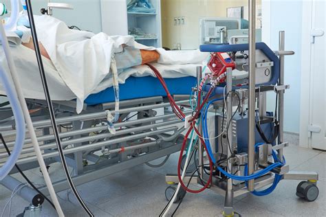 Ecmo In Circulatory Failure Extracorporeal Support And Care The