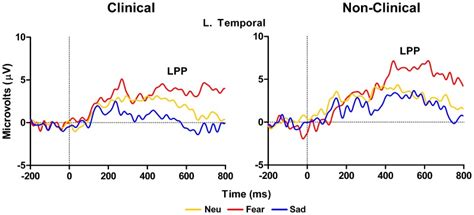 Grand Average Waveforms From Left Temporal Electrodes Showing A Larger Download Scientific