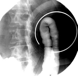 Gastrointestinal Radiology