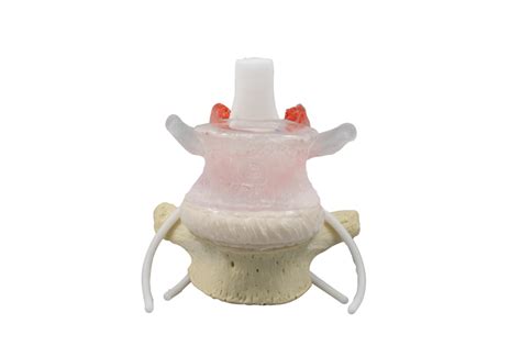 Precision Lumbar Spine Models For Accurate Diagnosis And Education
