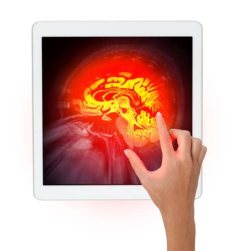 A Hand Touches A Tablet Screen Displaying A Brightly Highlighted Mri