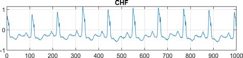 GitHub Farhadabedinzadeh Classify Time Series Using Deep Learning