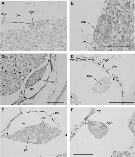 Transverse Sections Of Roach Gonads Showing The Normal Progression Of Download Scientific