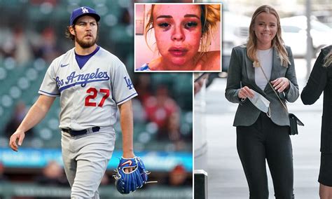 Trevor Bauer Lindsey Hill Agree To Settle Lawsuits With Each Other