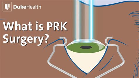 What Is Prk Surgery Duke Health Youtube