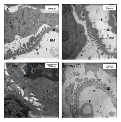 Representative Micrographs Of Electron Microscopy Of Renal Capillary
