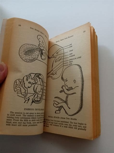 The Stork Didnt Bring You Sex Education Medical Book Etsy